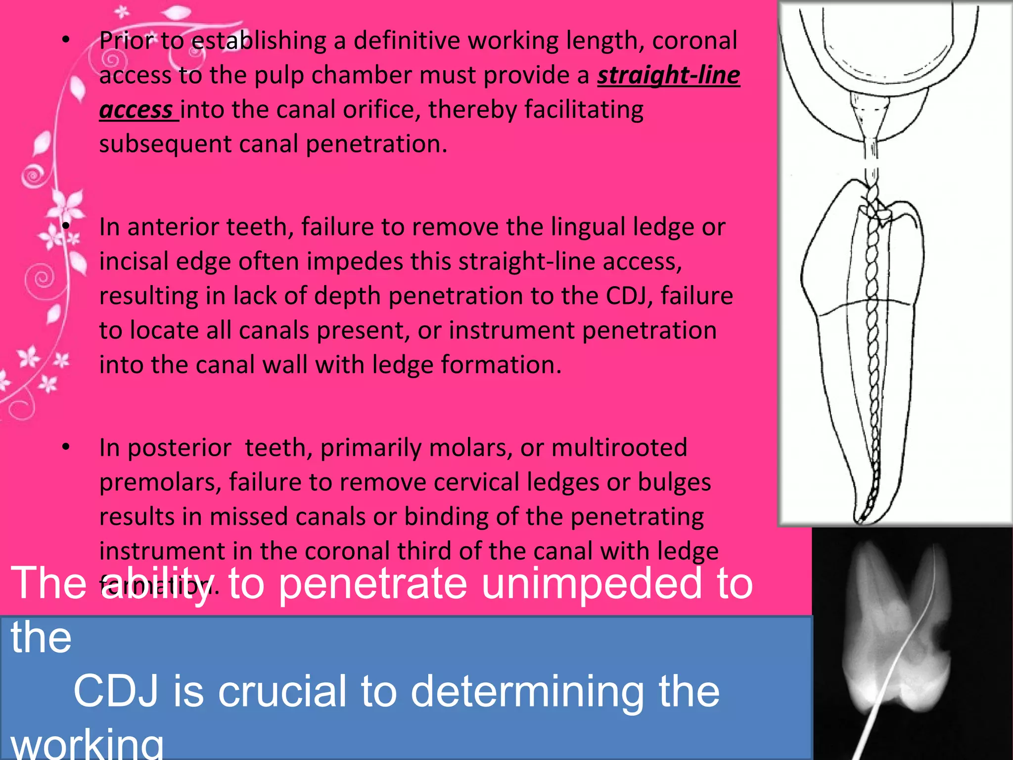 Working length determination | PPT