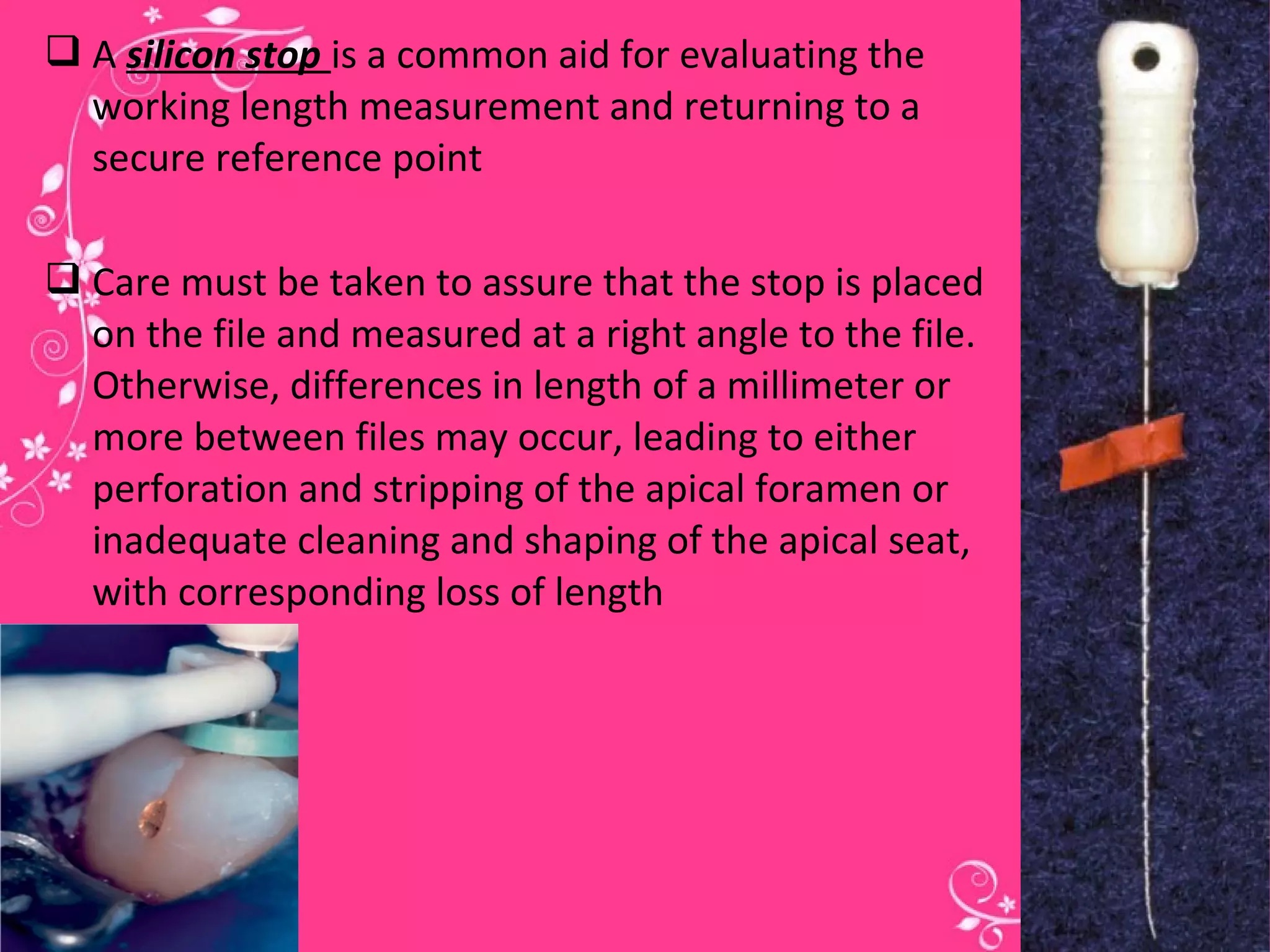 Working length determination | PPT