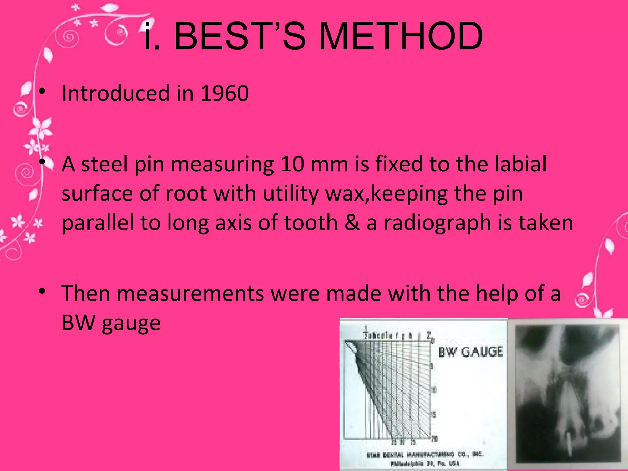 Working length determination | PPT