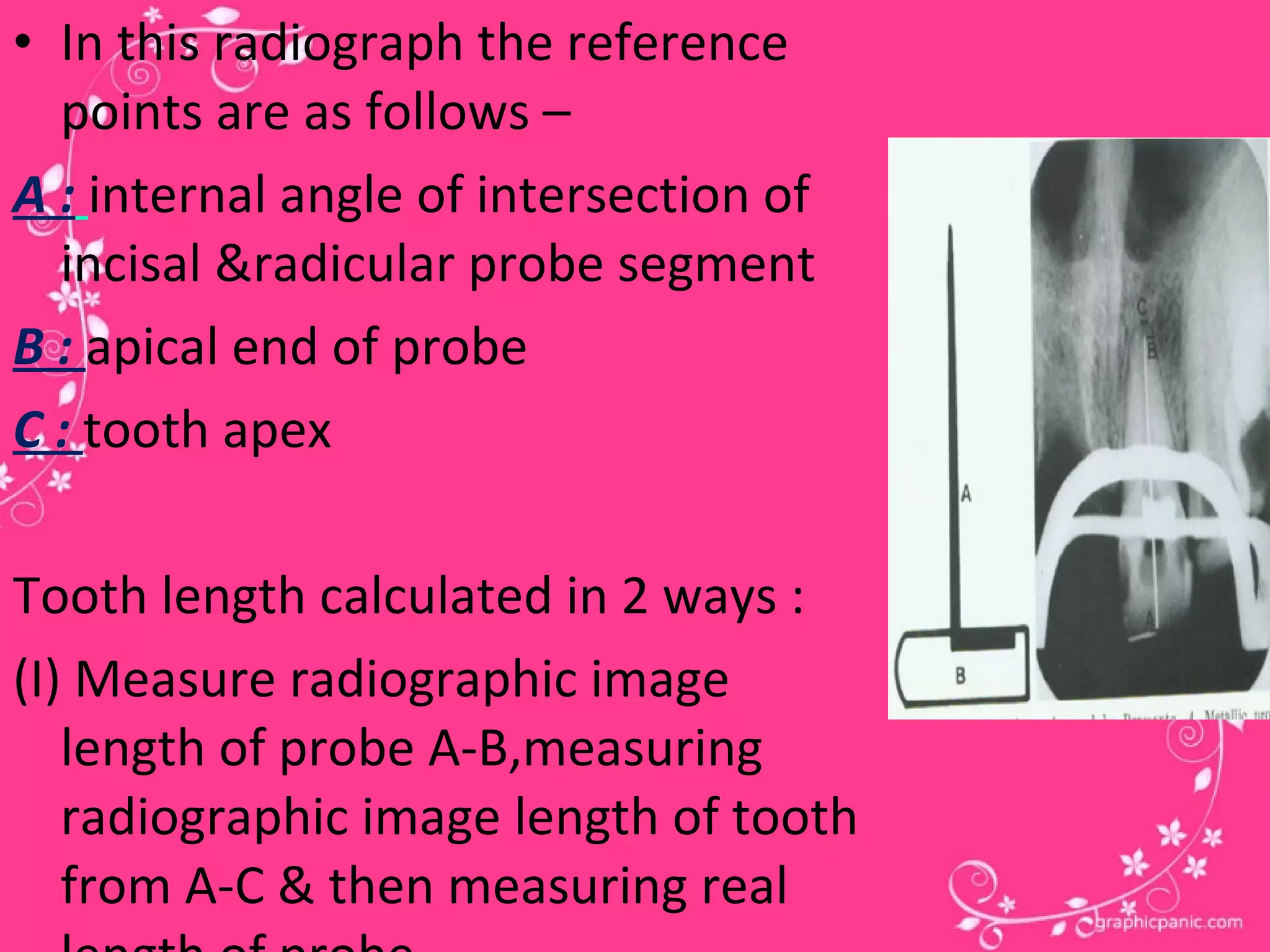 Working Length Determination Ppt Dental Health Diseases And Conditions