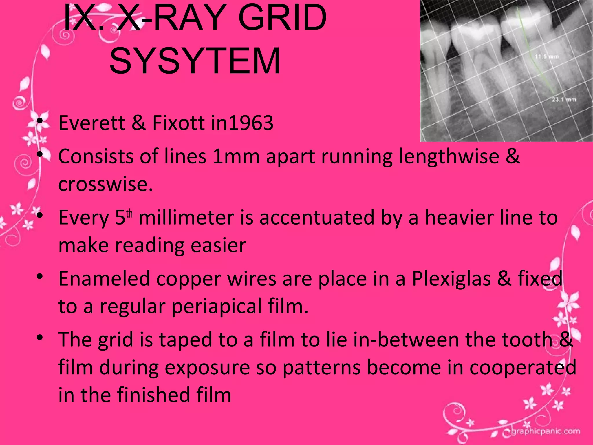 Working length determination | PPT