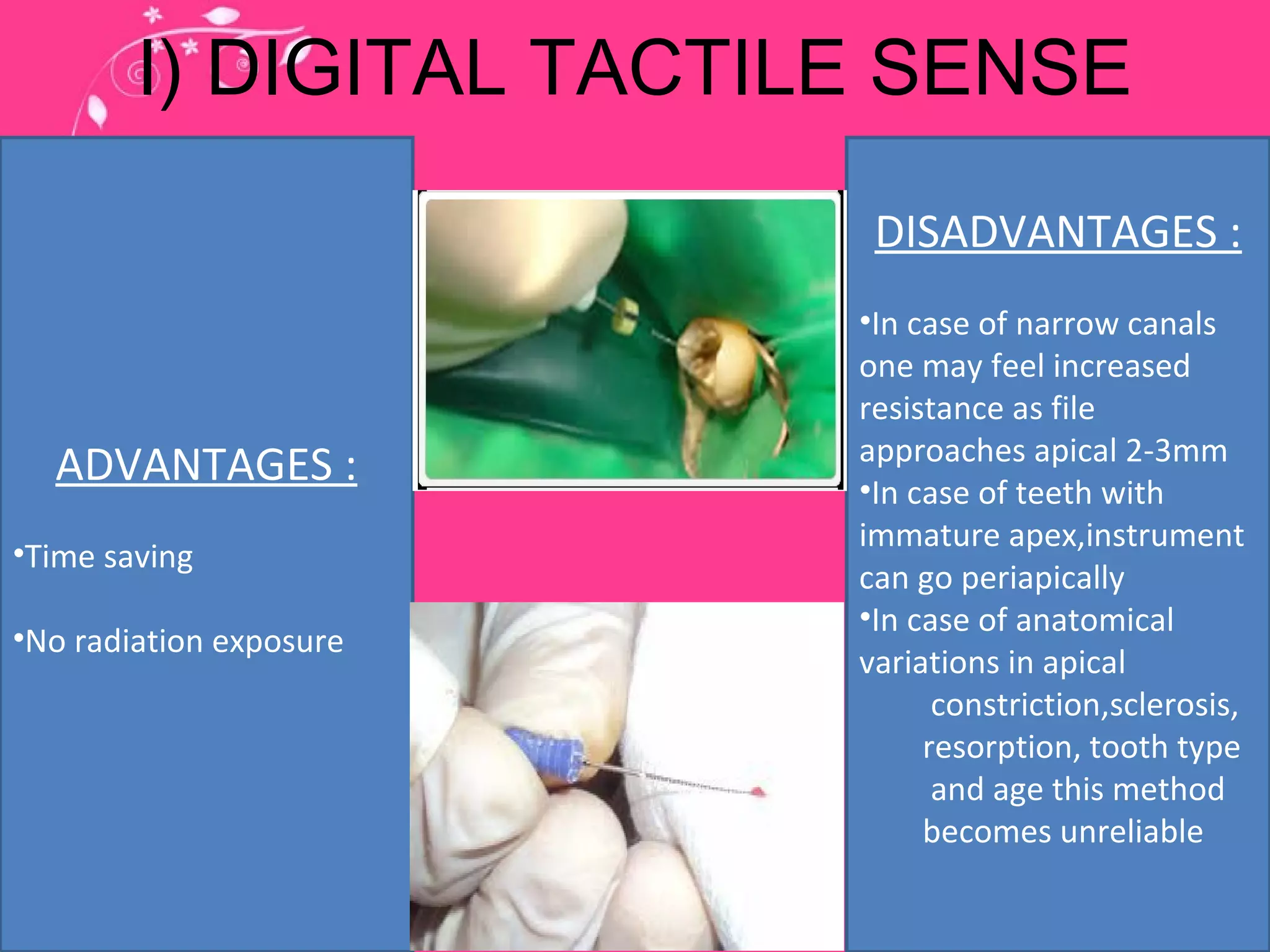 Working length determination | PPT