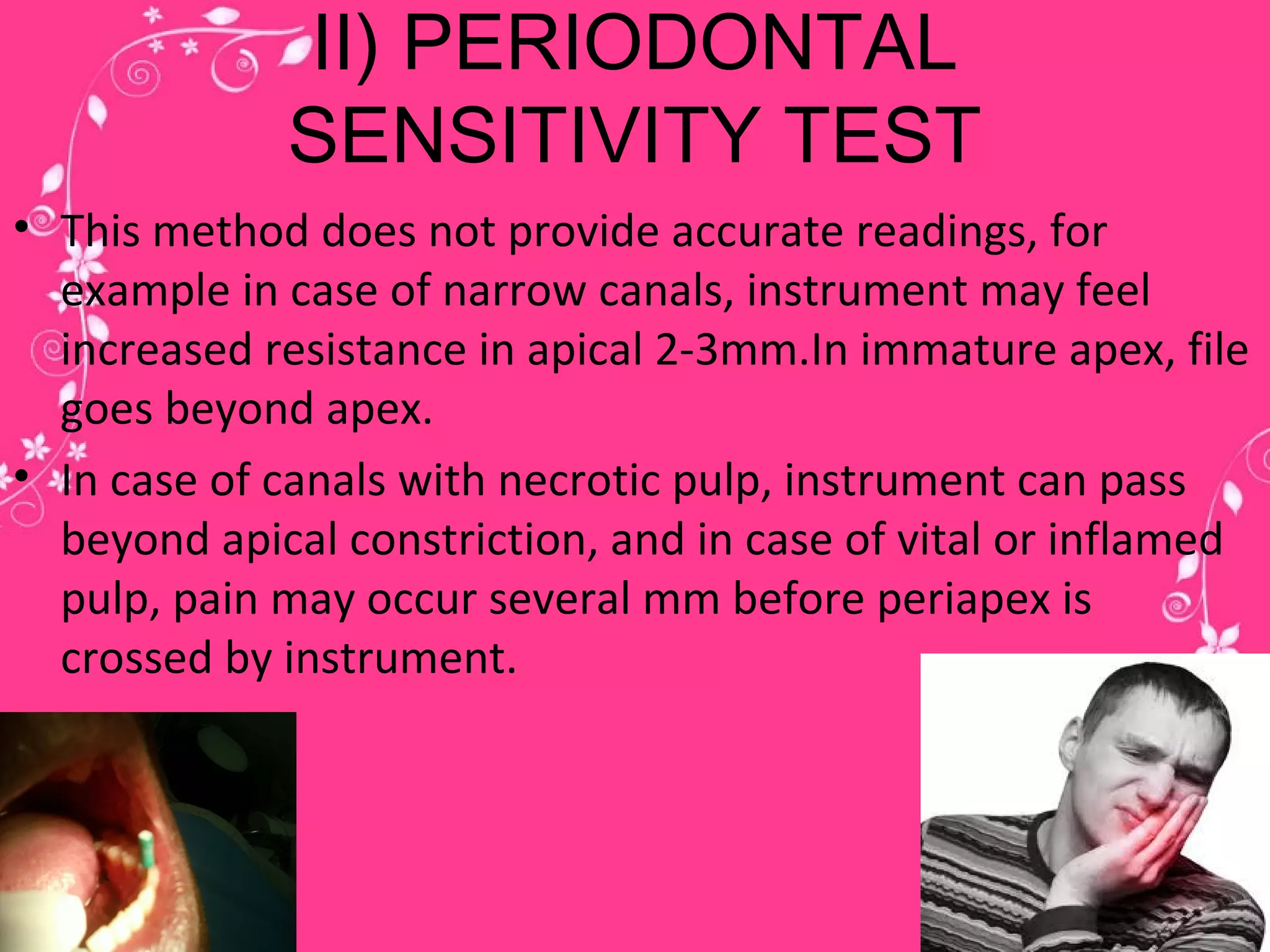 Working length determination | PPT