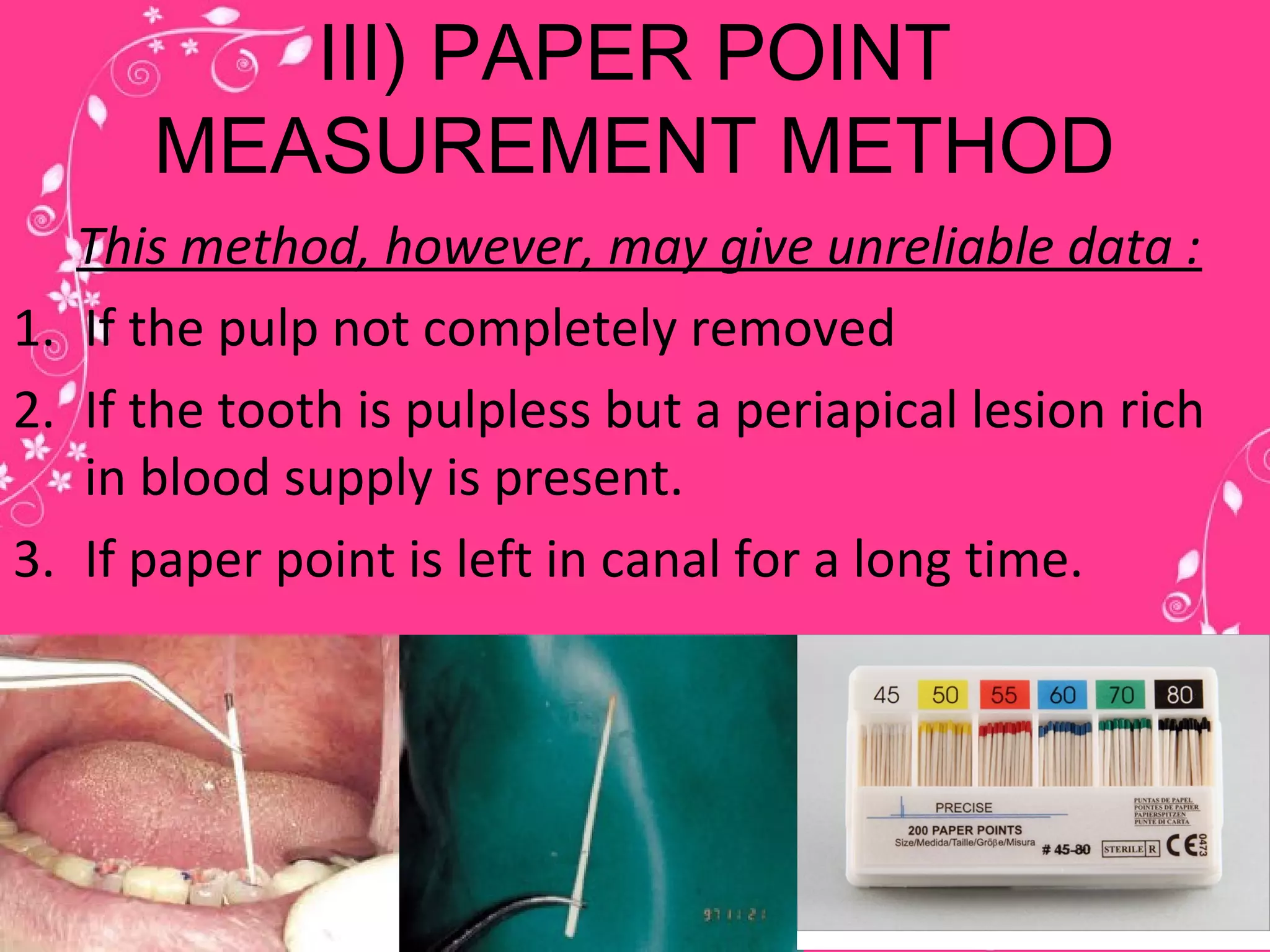 Working length determination | PPT