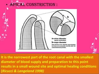 Working length determination | PPT