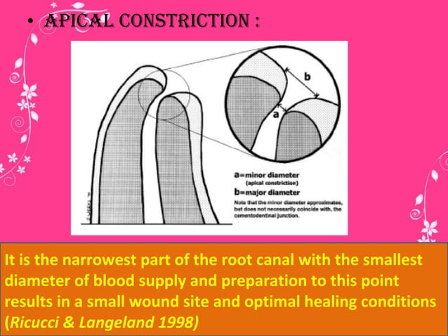 Working length determination | PPT | Dental Health | Diseases and ...