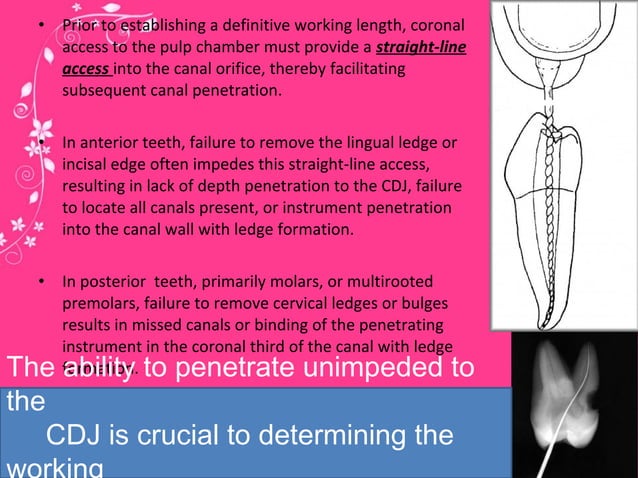 Working length determination | PPT | Dental Health | Diseases and ...