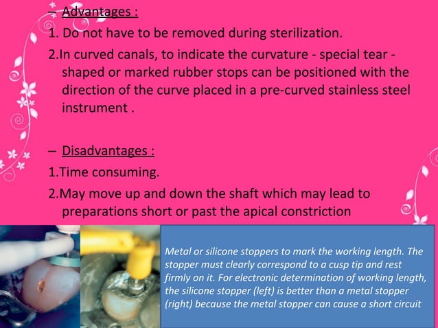 Working length determination | PPT | Dental Health | Diseases and ...