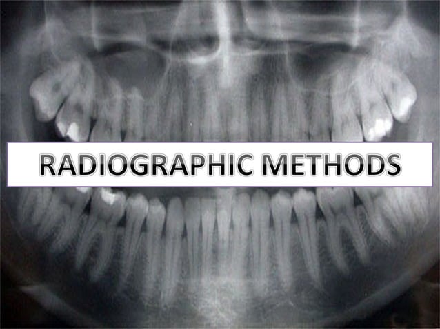 Working length determination | PPT | Dental Health | Diseases and ...