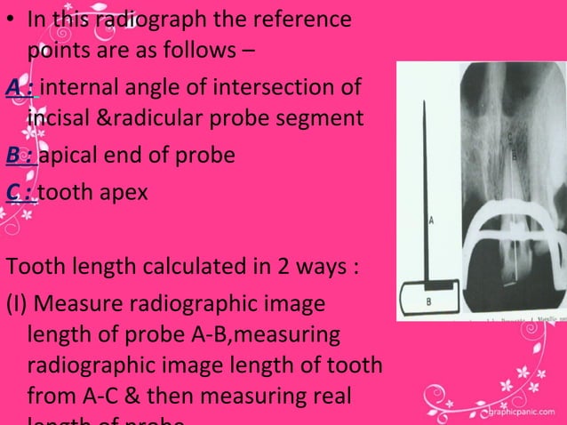 Working length determination | PPT | Dental Health | Diseases and ...