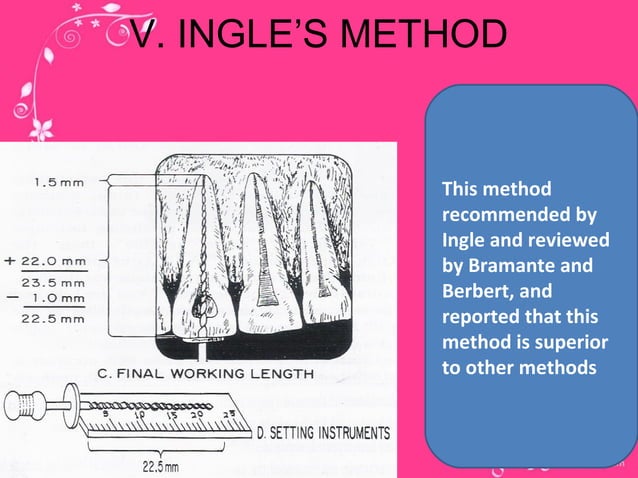 Working length determination | PPT | Dental Health | Diseases and ...