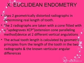 Working length determination | PPT