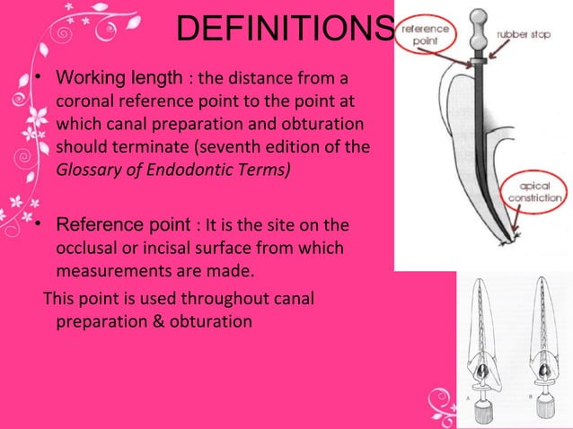 Working length determination | PPT | Dental Health | Diseases and ...