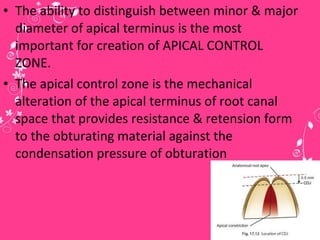 Working length determination | PPT