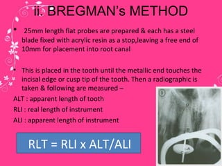Working length determination | PPT