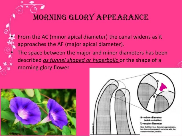 Working length determination