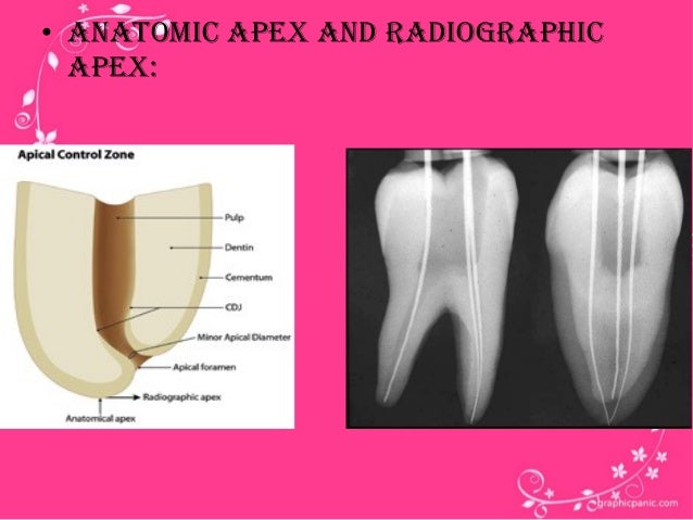 Working length determination