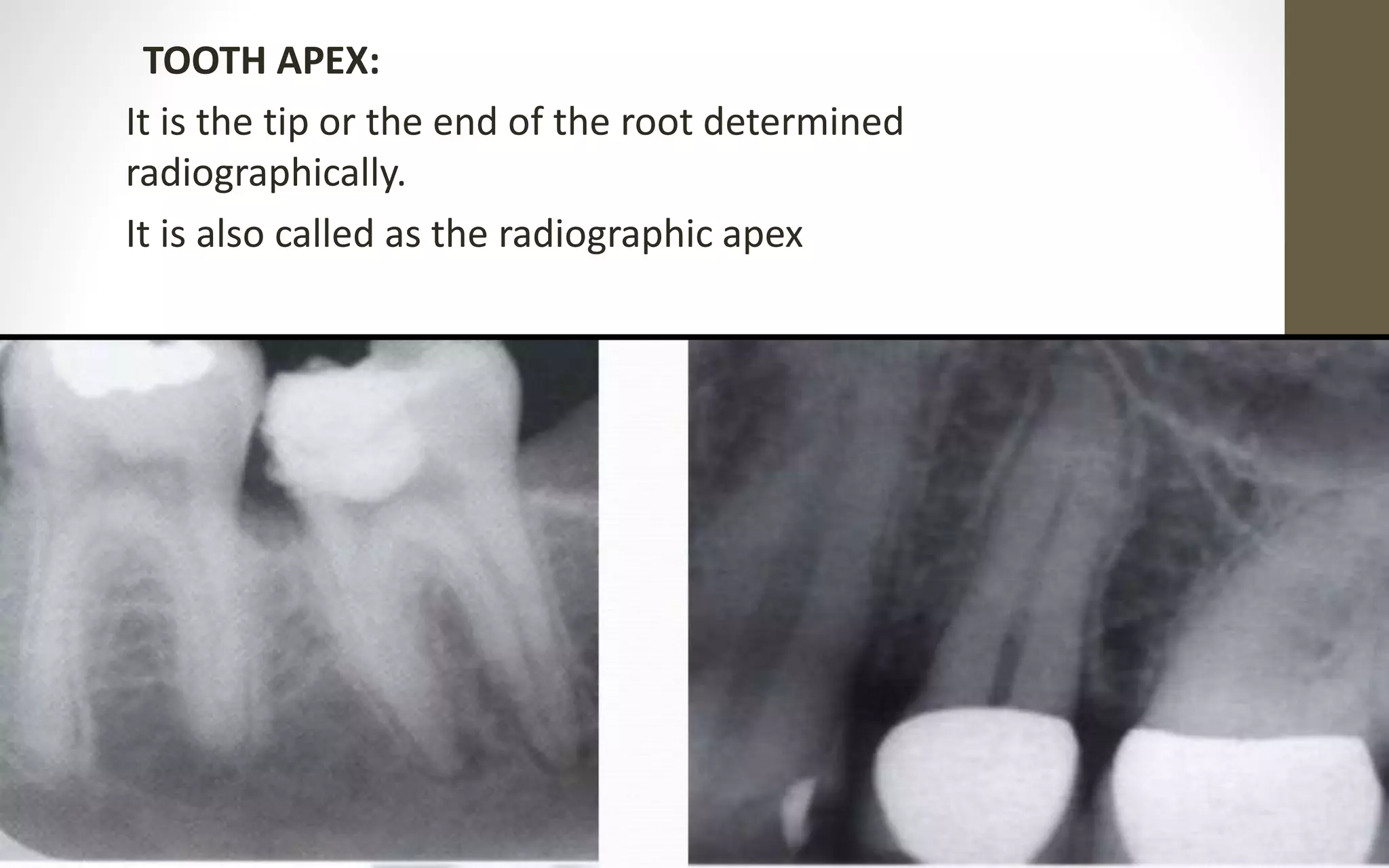 Working length determination | PPTX