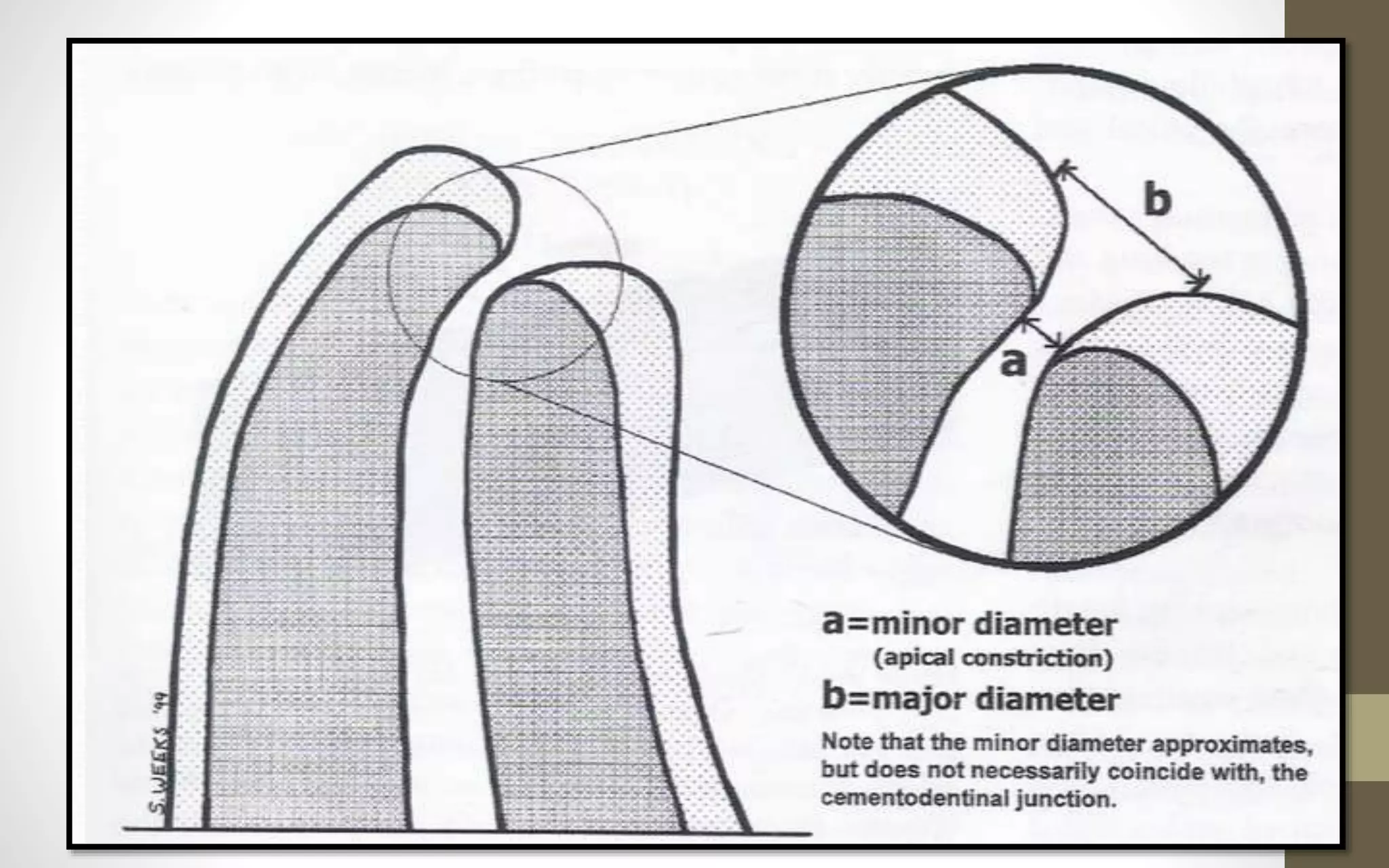 Working length determination | PPTX