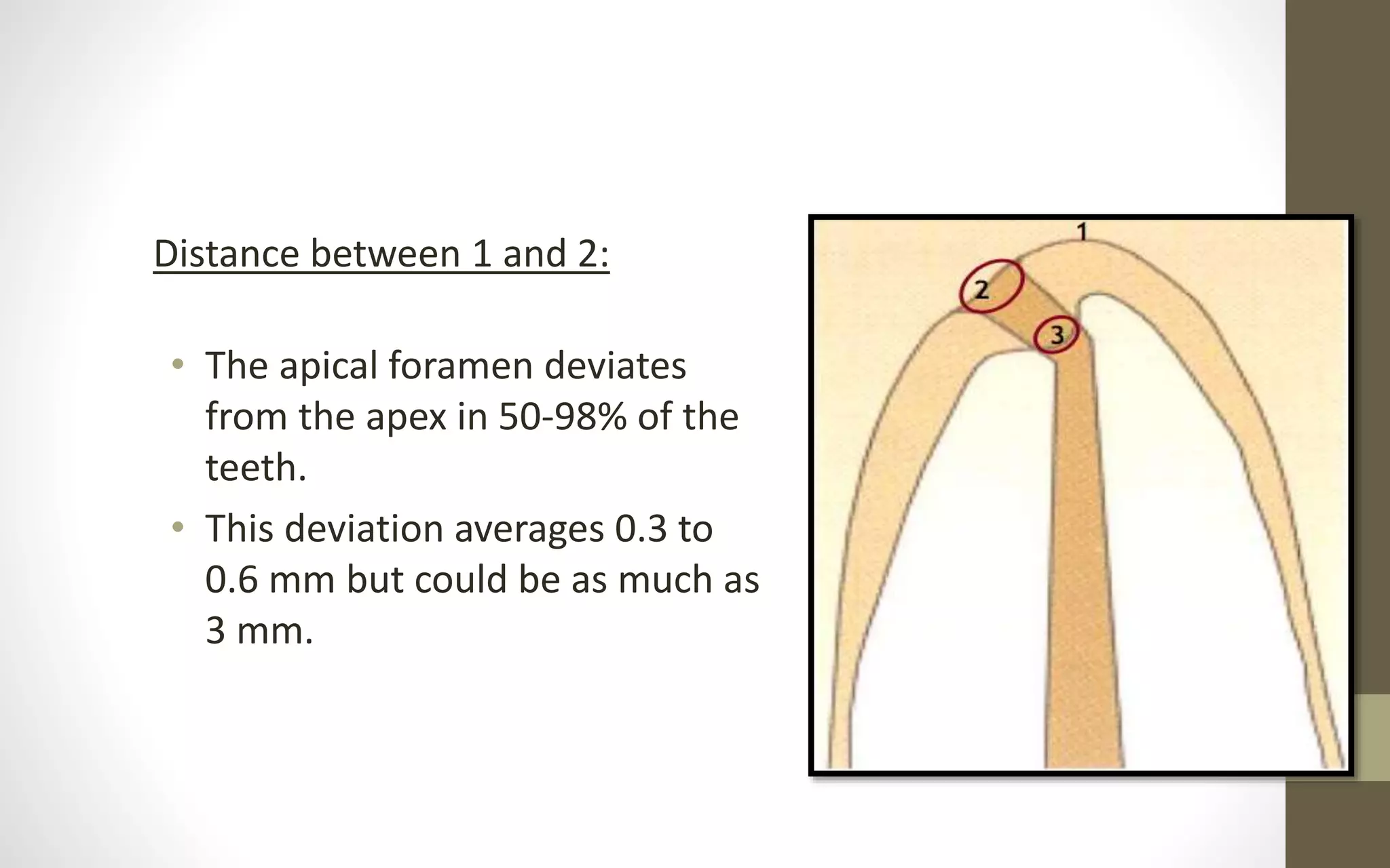 Working length determination | PPTX
