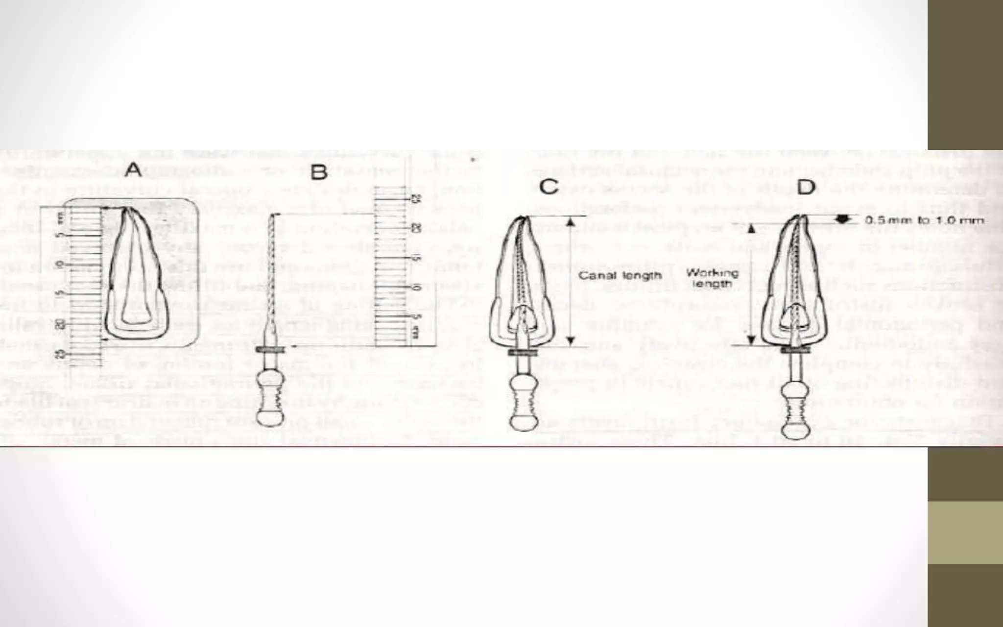 Working length determination | PPTX