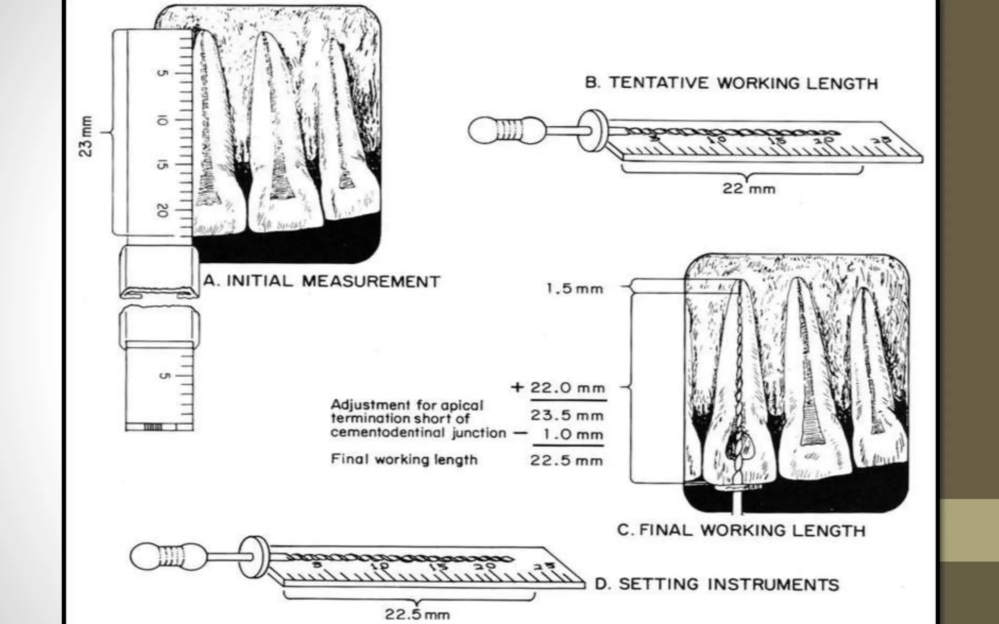 Working length determination | PPTX