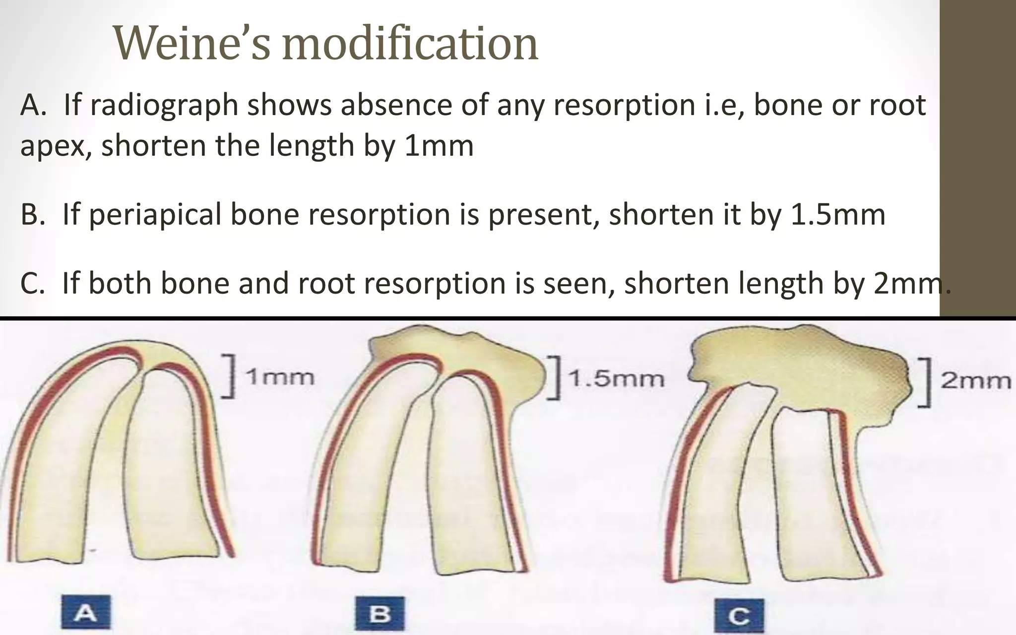 Working length determination | PPTX