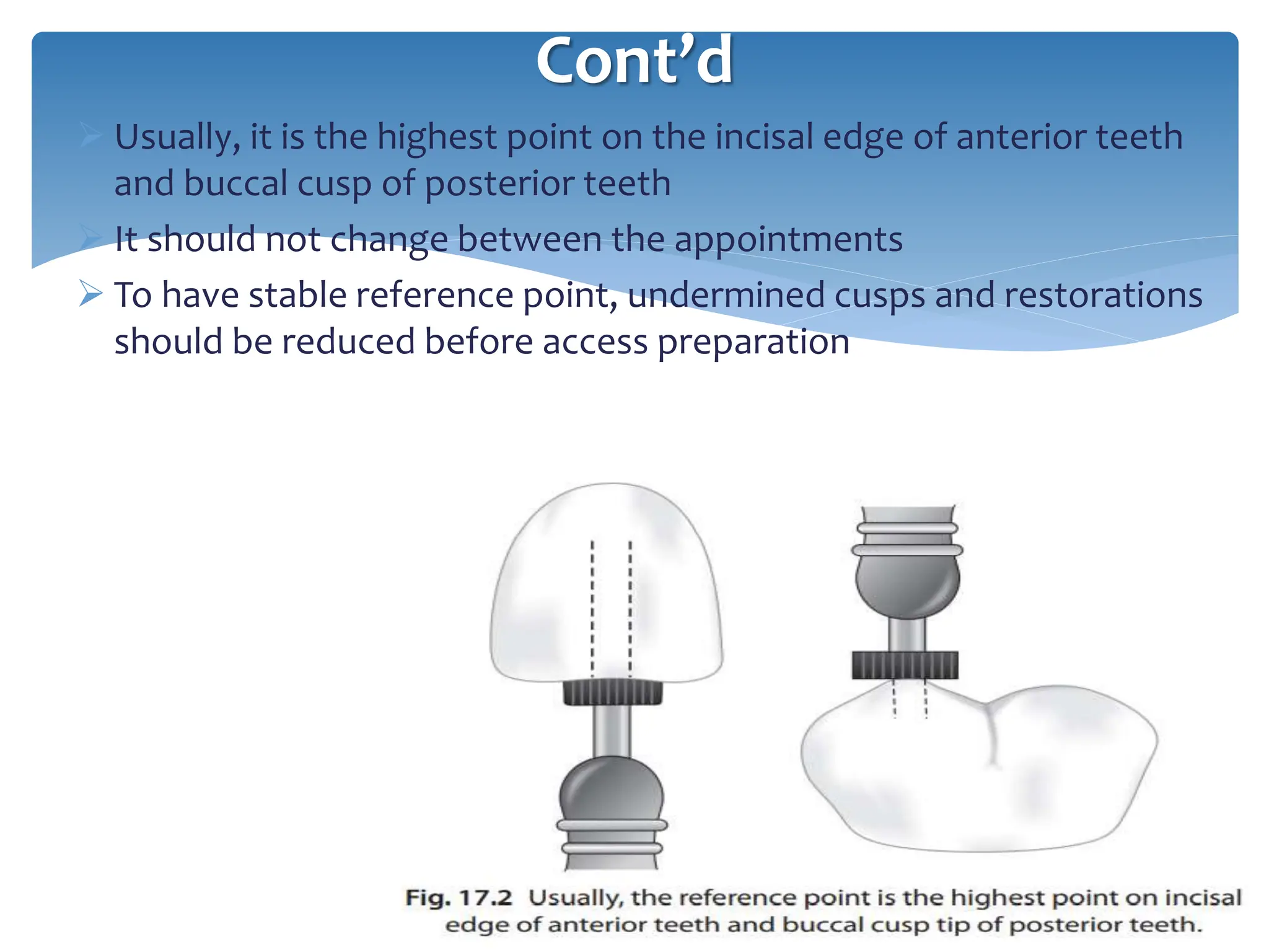 WORKING LENGTH DETERMINATION in endodontics-2.pptx
