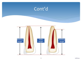 WORKING LENGTH DETERMINATION in endodontics-2.pptx