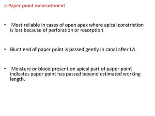Working length determination | PPTX