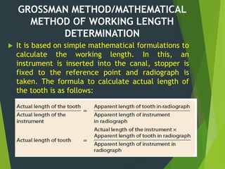 Working length determination | PPTX