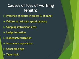 Working length determination | PPTX