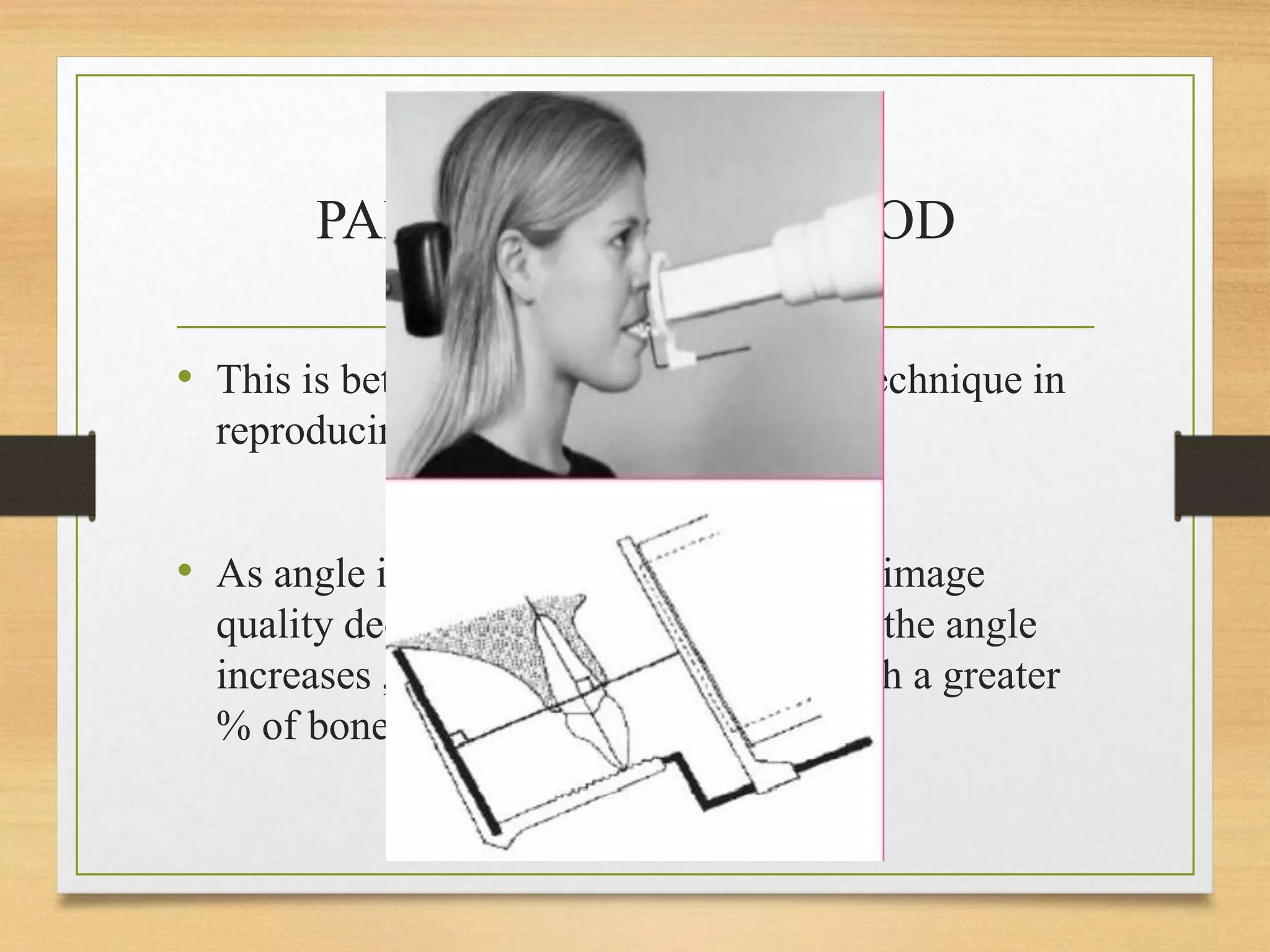 working length determination.pptx