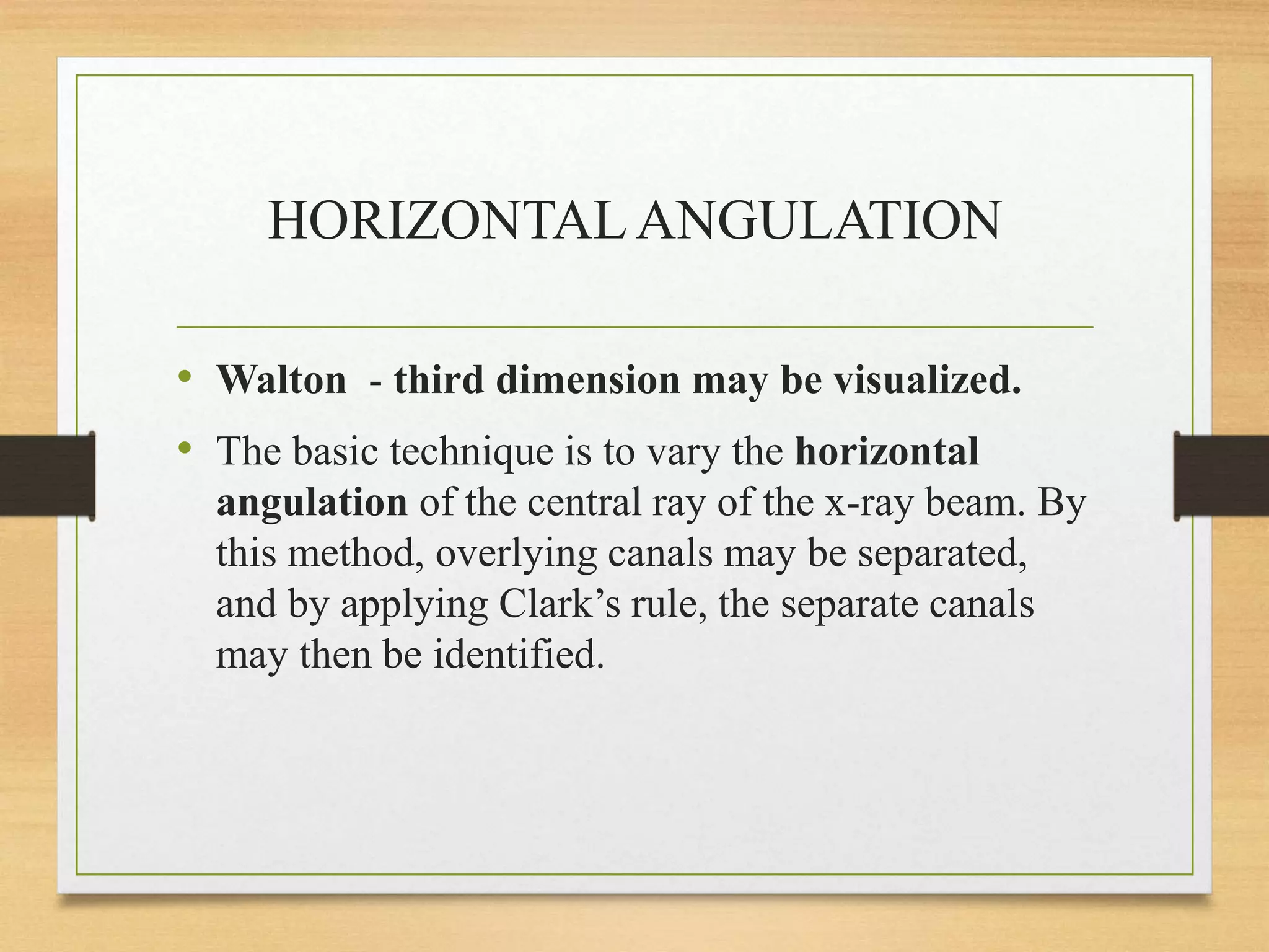 working length determination.pptx