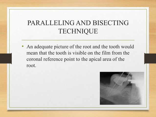 working length determination.pptx | Dental Health | Diseases and Conditions