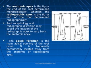 Working length determination /prosthodontic courses | PPT