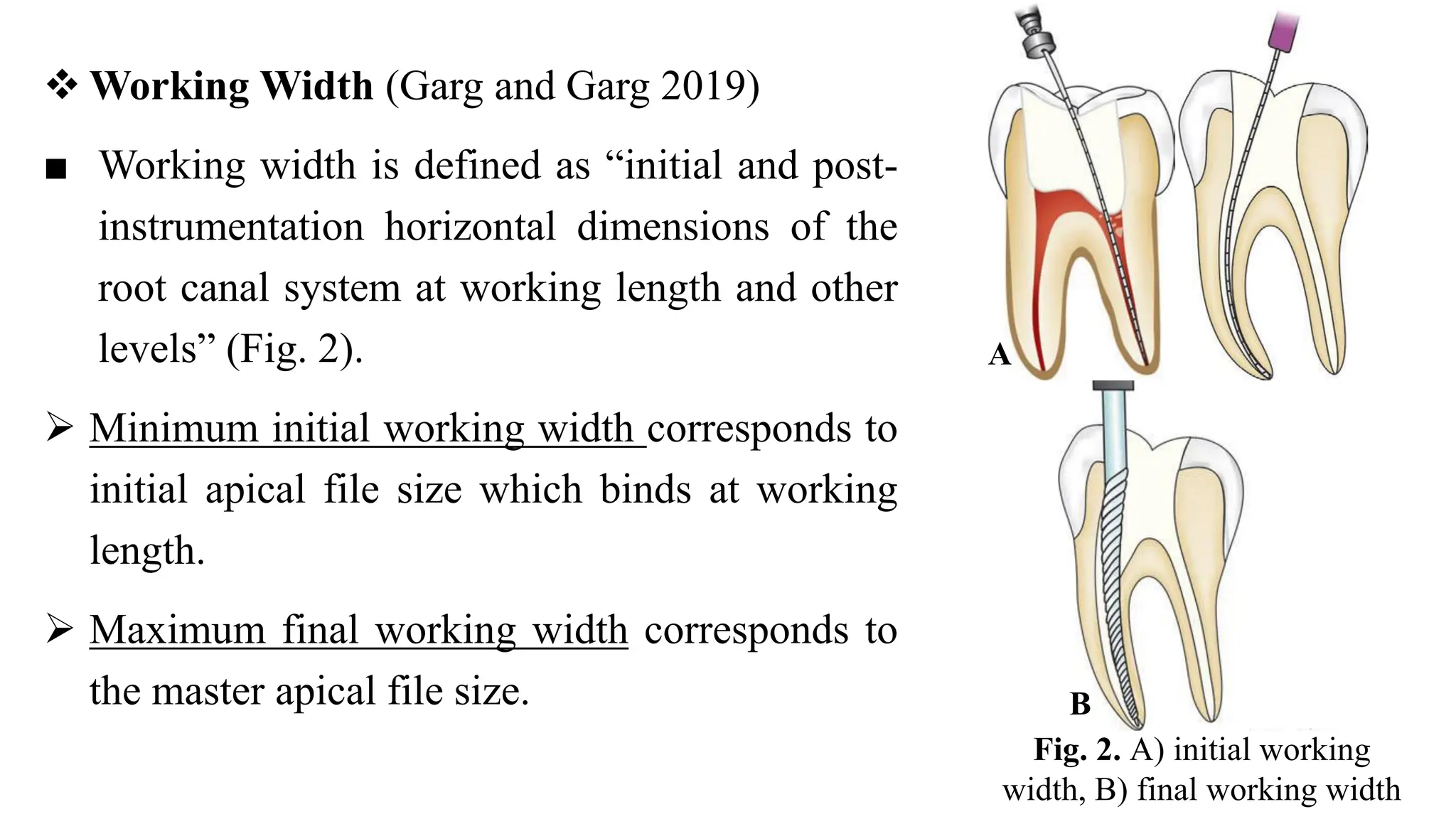 Working length determination endodontist | PDF