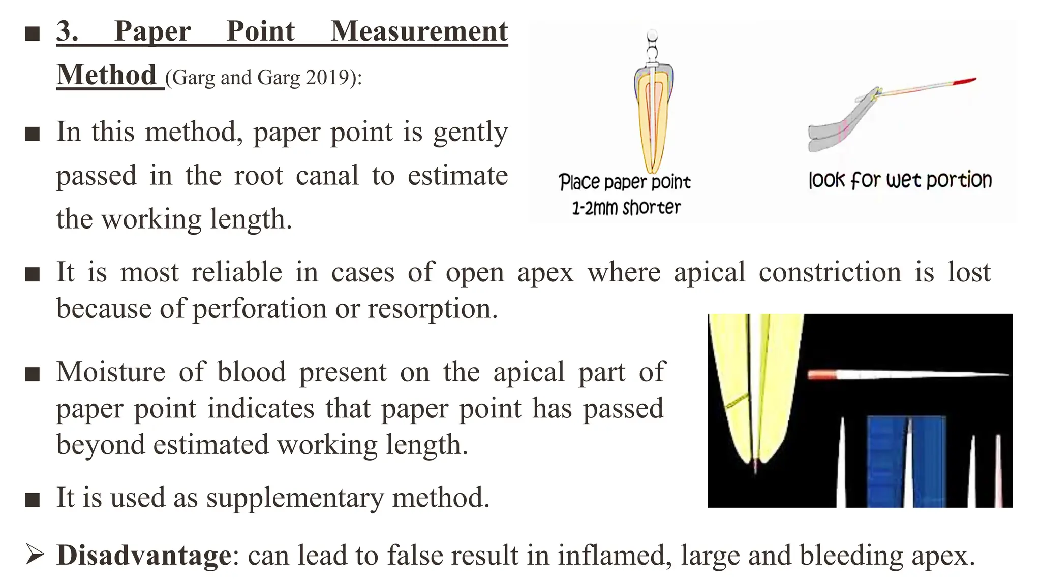 Working length determination endodontist | PDF