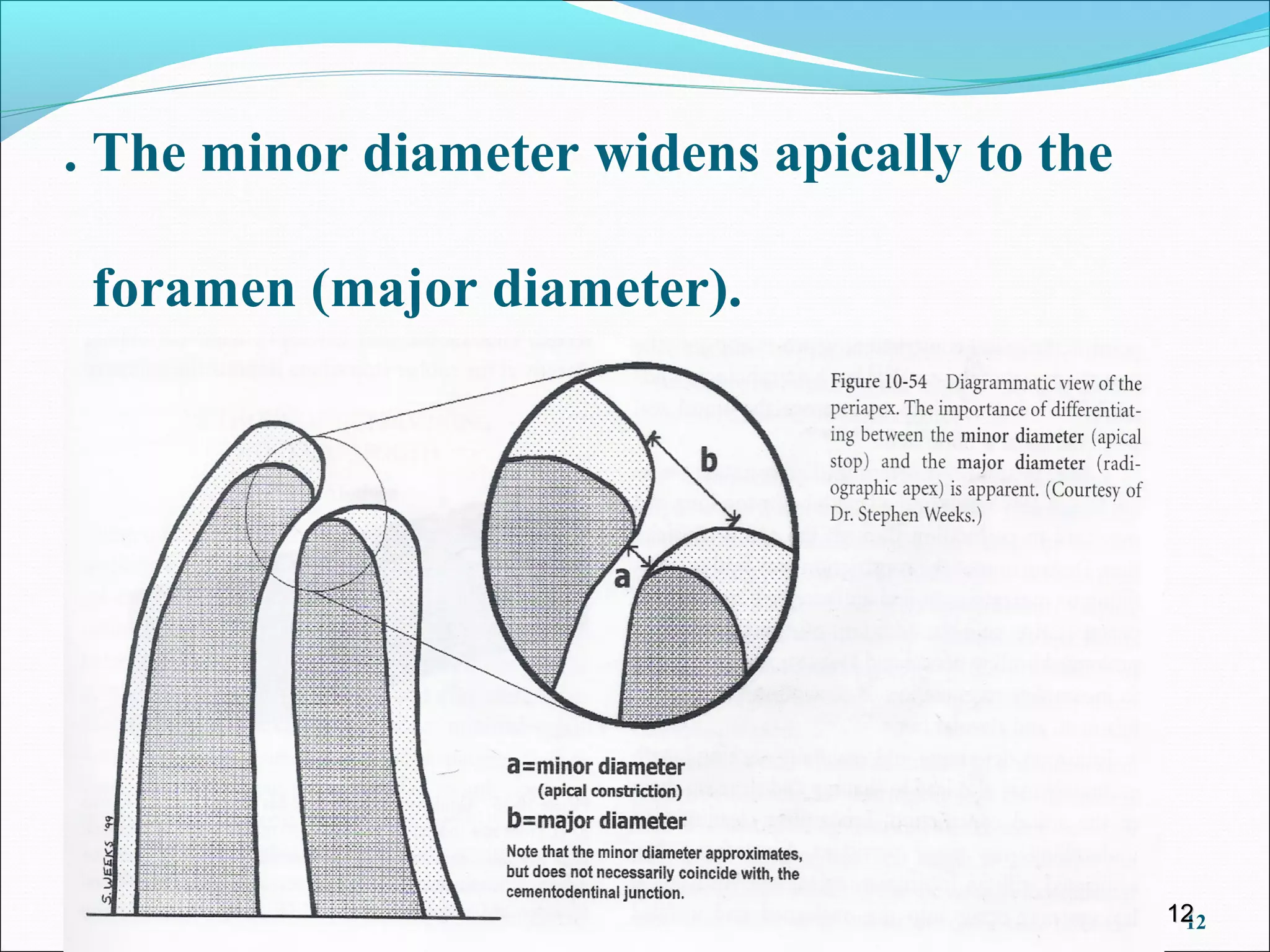 Working Length Determination Ppt