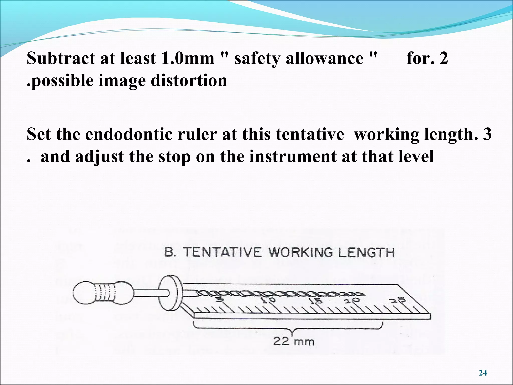 Working length determination | PPT