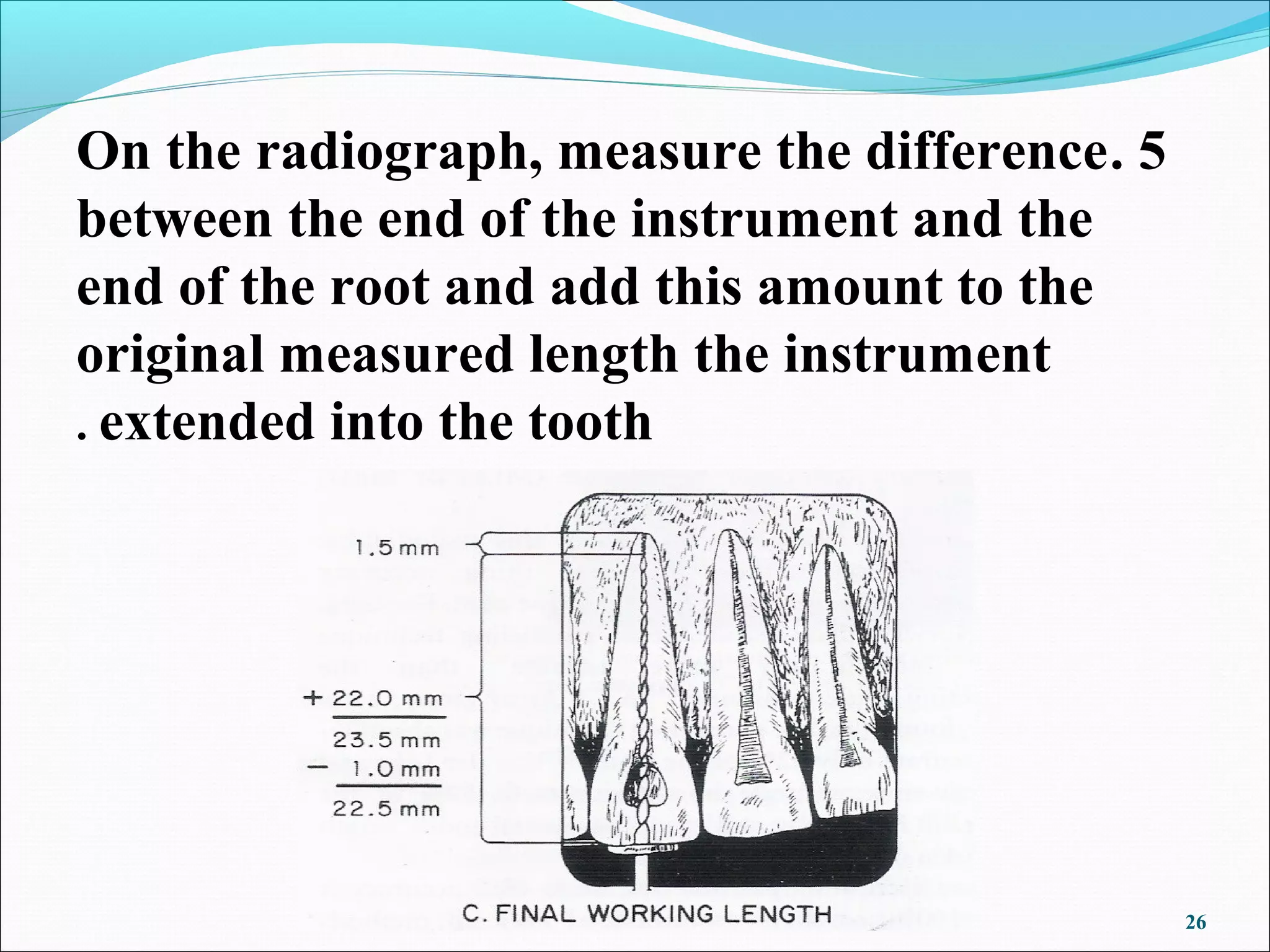 Working length determination | PPT
