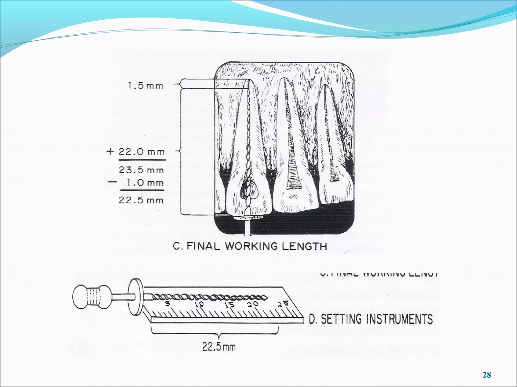 Working length determination | PPT