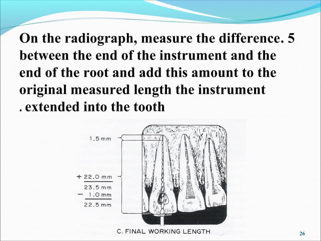Working length determination | PPT | Dental Health | Diseases and ...