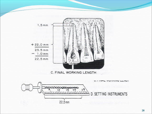 Working length determination | PPT | Dental Health | Diseases and ...