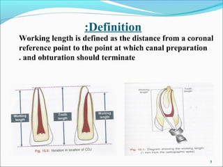 Working length determination | PPT
