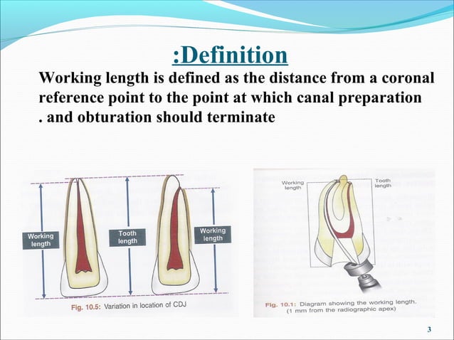 Working length determination | PPT | Dental Health | Diseases and ...