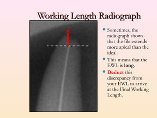 Workinglength lect 3 | PPT