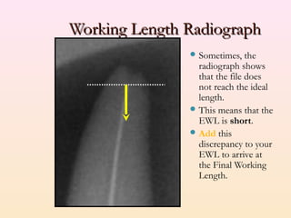 Workinglength lect 3 | PPT