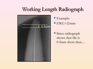 Workinglength lect 3 | PPT