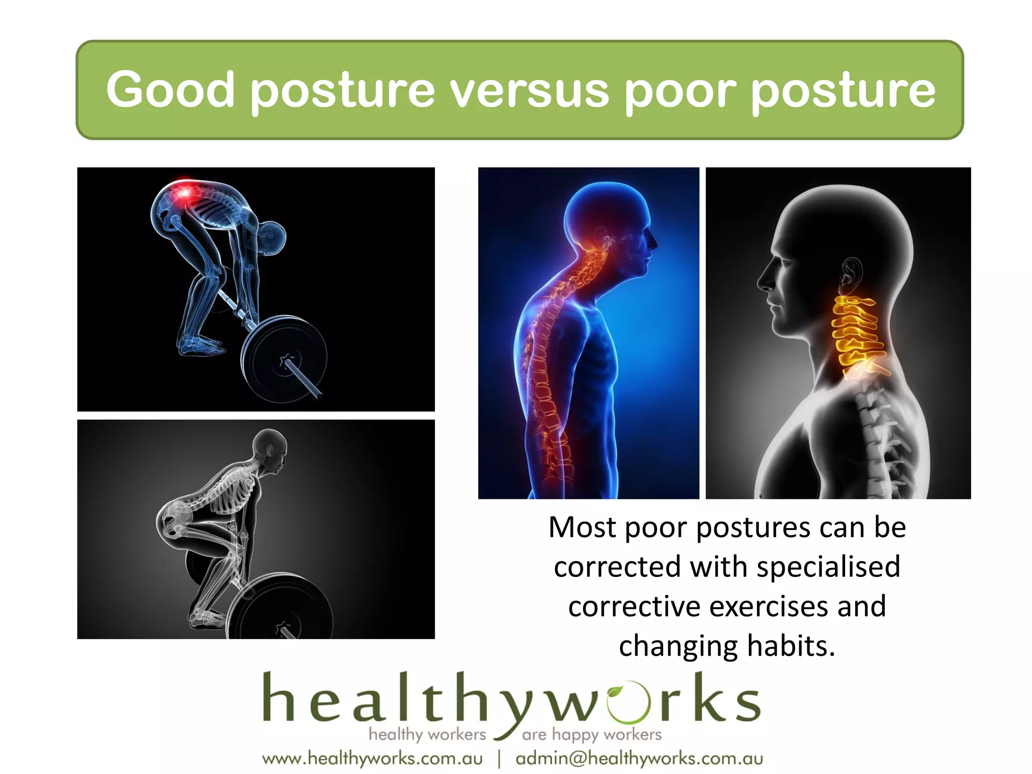 Workplace Ergonomics & Injury Prevention Sneak Peak | PDF